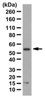 Anti-CCN1/CYR61 Antibody | ABC102